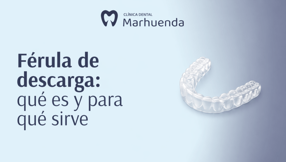 Férula de descarga: qué es y para qué sirve | Clínica Dental Marhuenda