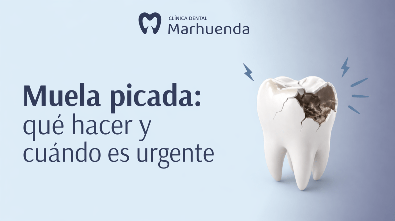 Muela picada: qué hacer y cuándo es urgente | Clínica Dental Marhuenda